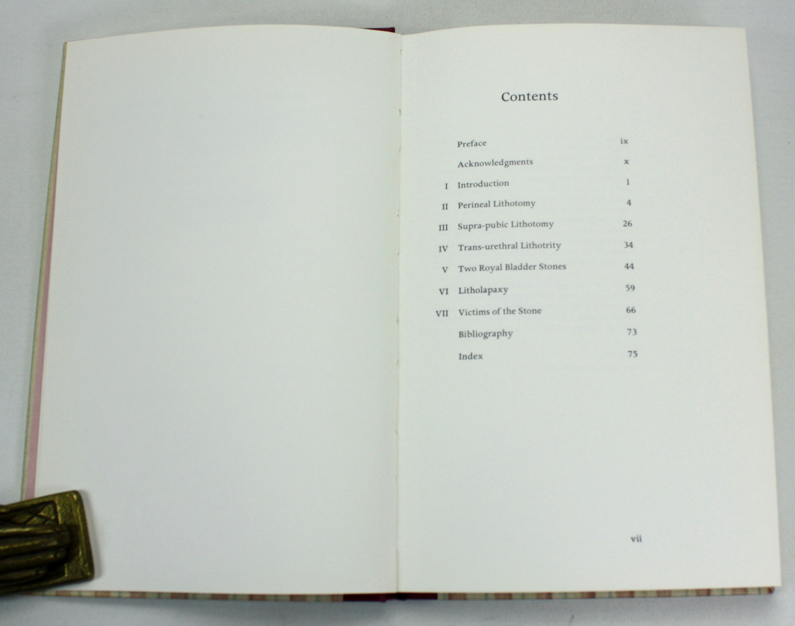 Medicine; A History of Bladder Stone, Harold Ellis, Blackwell Scientif ...