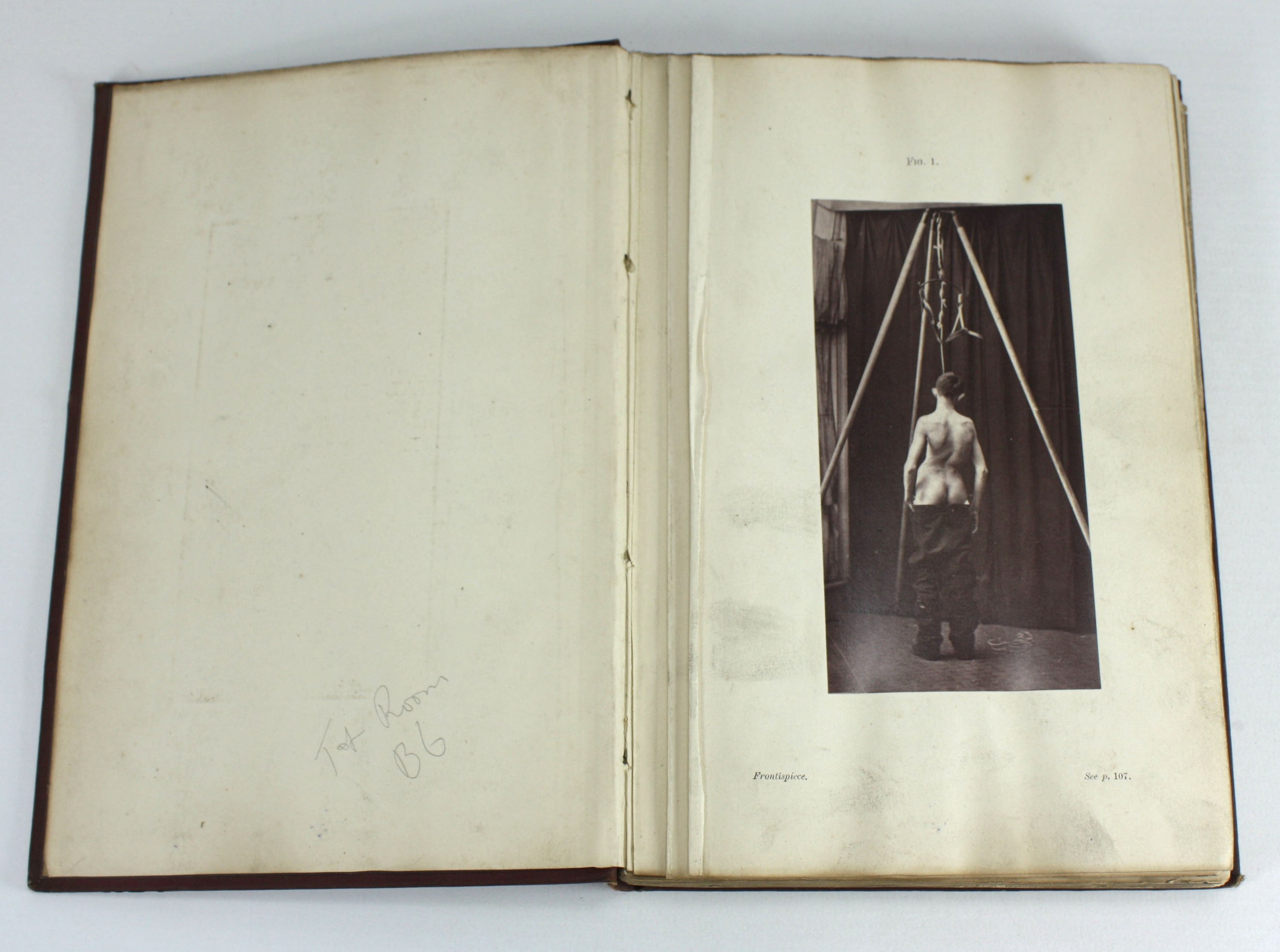 Spinal Disease and Spinal Curvature, by Lewis A Sayre, 1877 — Lanna Antique