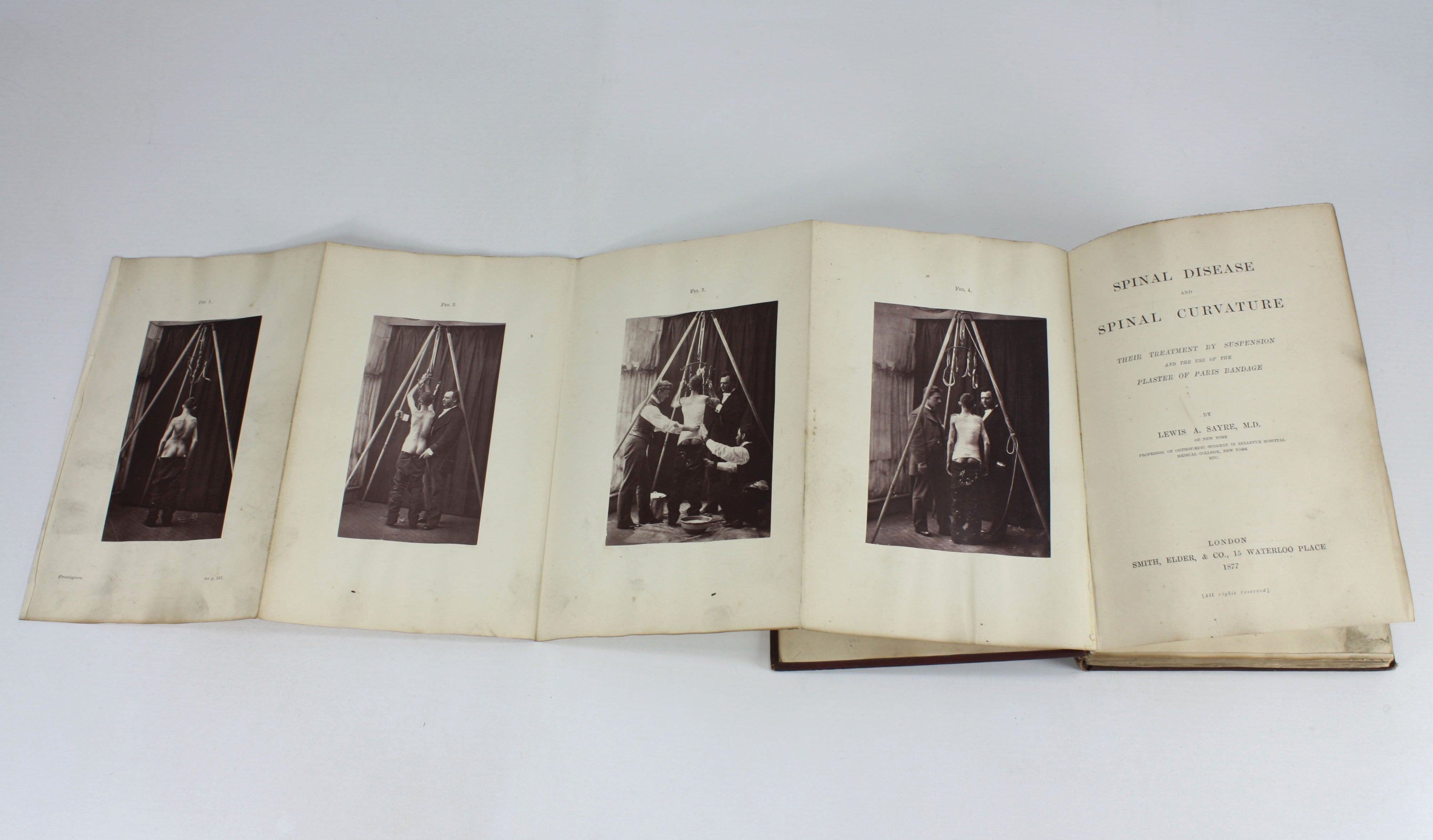 Spinal Disease and Spinal Curvature, by Lewis A Sayre, 1877 — Lanna Antique