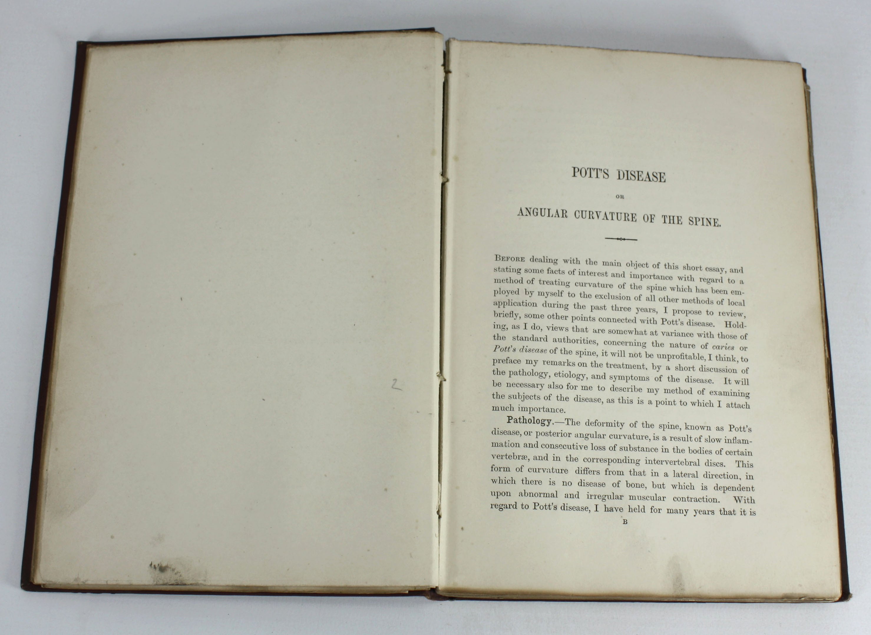 Spinal Disease and Spinal Curvature, by Lewis A Sayre, 1877 — Lanna Antique